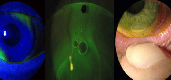 Controlling Fogging and Lens Awareness with Onefit™ MED - BRADLEY ...
